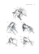 Atlas of Minimally Invasive Surgical Operations: Hunter, John G ...
